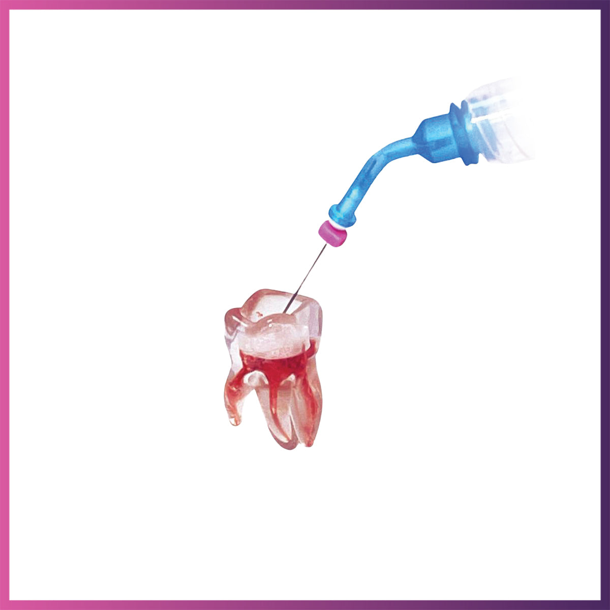 Root Canal 3D Resin Teeth Model – SoniDent